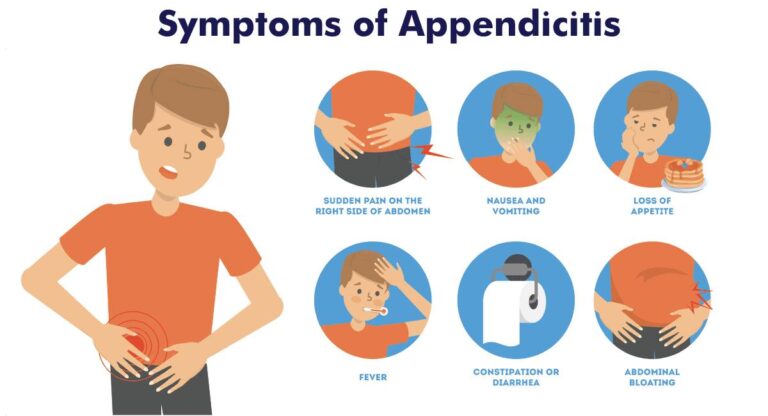 Appendicitis – Inflamed Appendix: Everything You Should Know