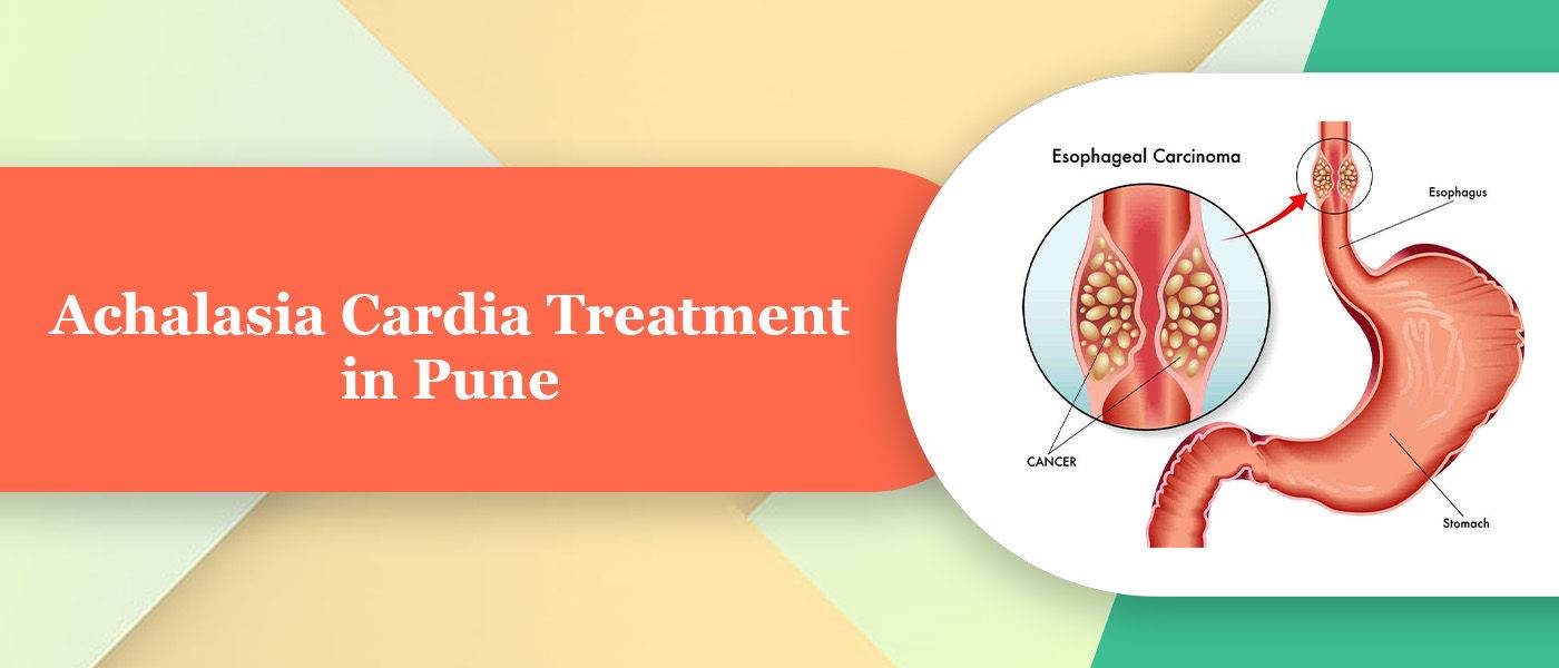 Types Of Achalasia