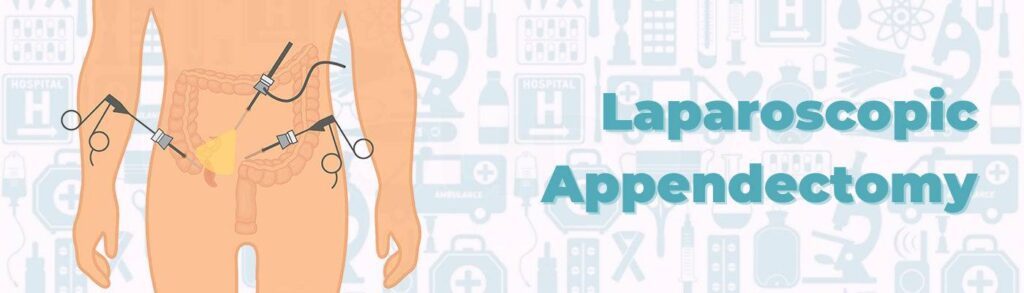 Laparoscopic Appendectomy Dr Samrat Jankar