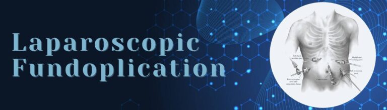 Laparoscopic Fundoplication Surgery in Pune, India | Laparoscopic ...
